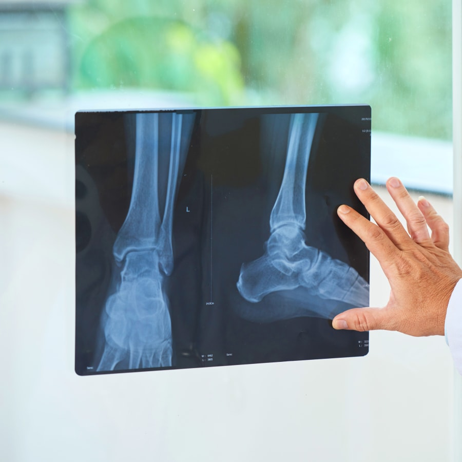 Extremeties X-Ray - Fast Care Diagnostics